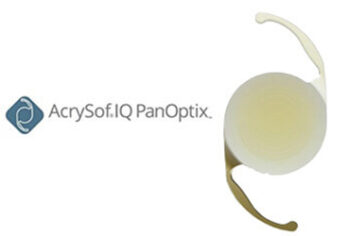 Clareon PanOptix（パンオプティクス）特徴とメリット・デメリット｜多焦点眼内レンズ