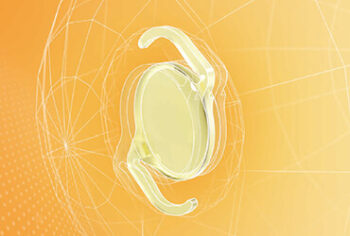 NSP NSP-3（ネックスロード）特徴とメリット・デメリット｜単焦点眼内レンズ